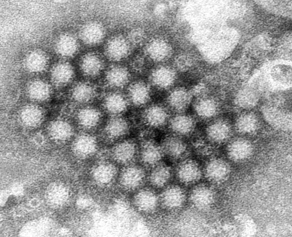 Nasty norovirus is back in full force with US cases of the stomach ...
