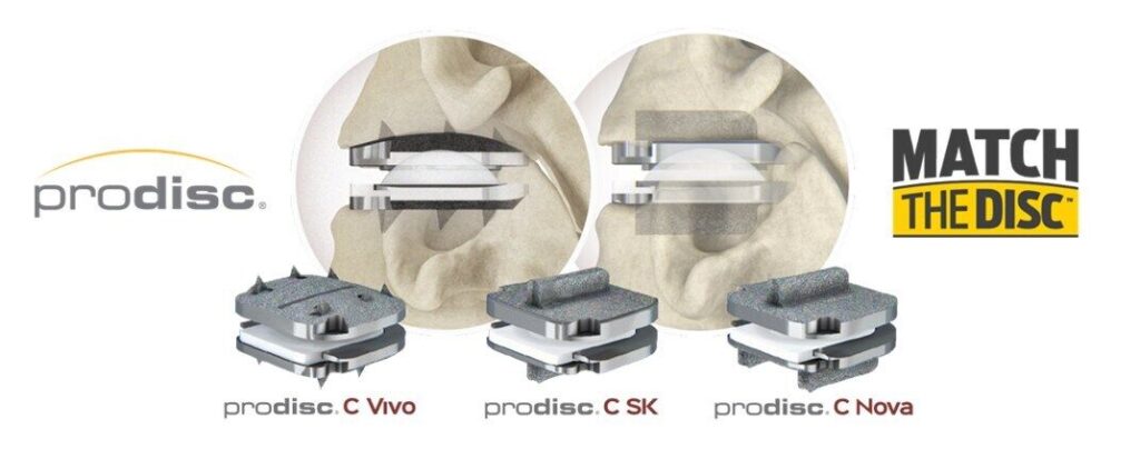 Over 10,000 Procedures Completed in U.S. with Centinel Spine's Match-the-Disc™ prodisc® Cervical ...