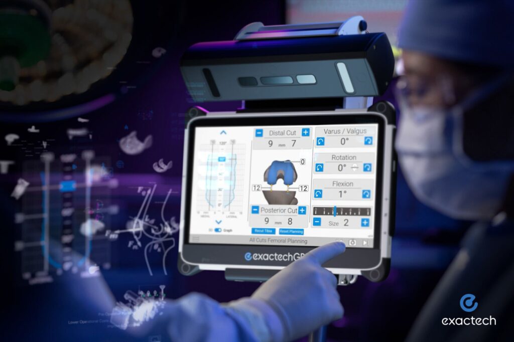 Exactech Secures Groundbreaking Patent, Paving the Way for the Next Generation of Personalized ...